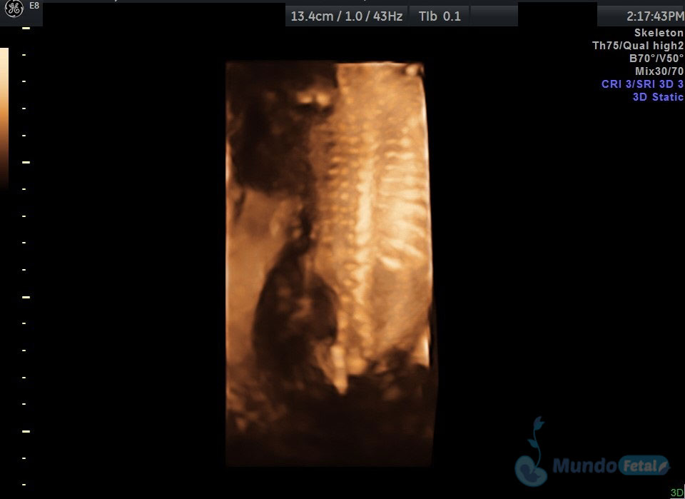 Mundo Fetal