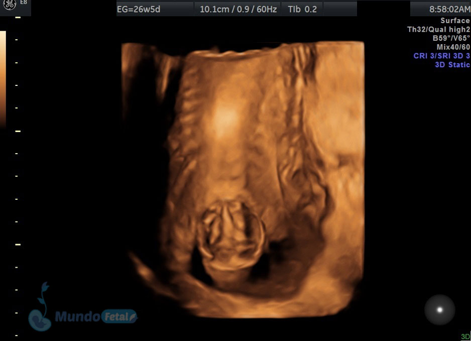 Mundo Fetal
